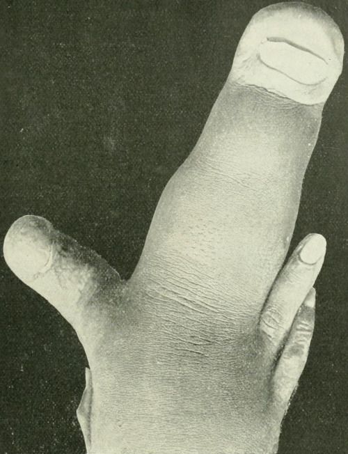Post an image showing the middle finger - Forums - MyAnimeList.net